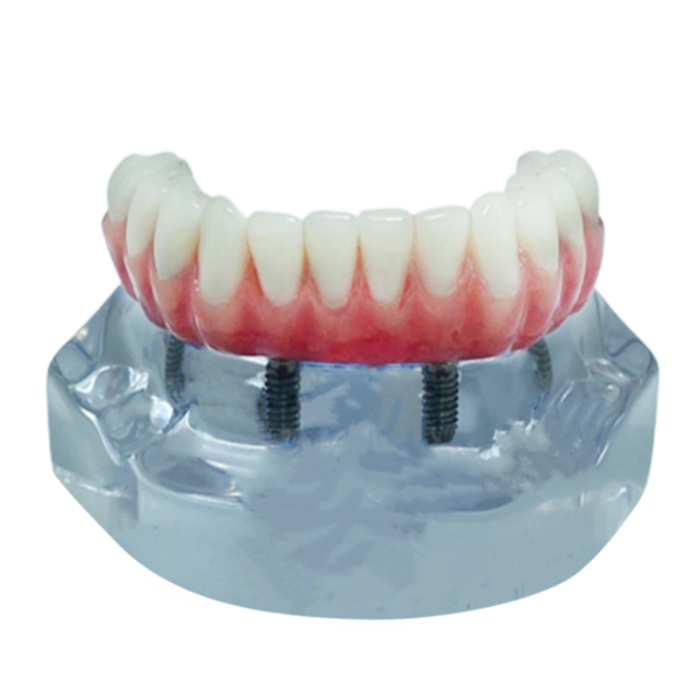 Modelo de protocolo dentário